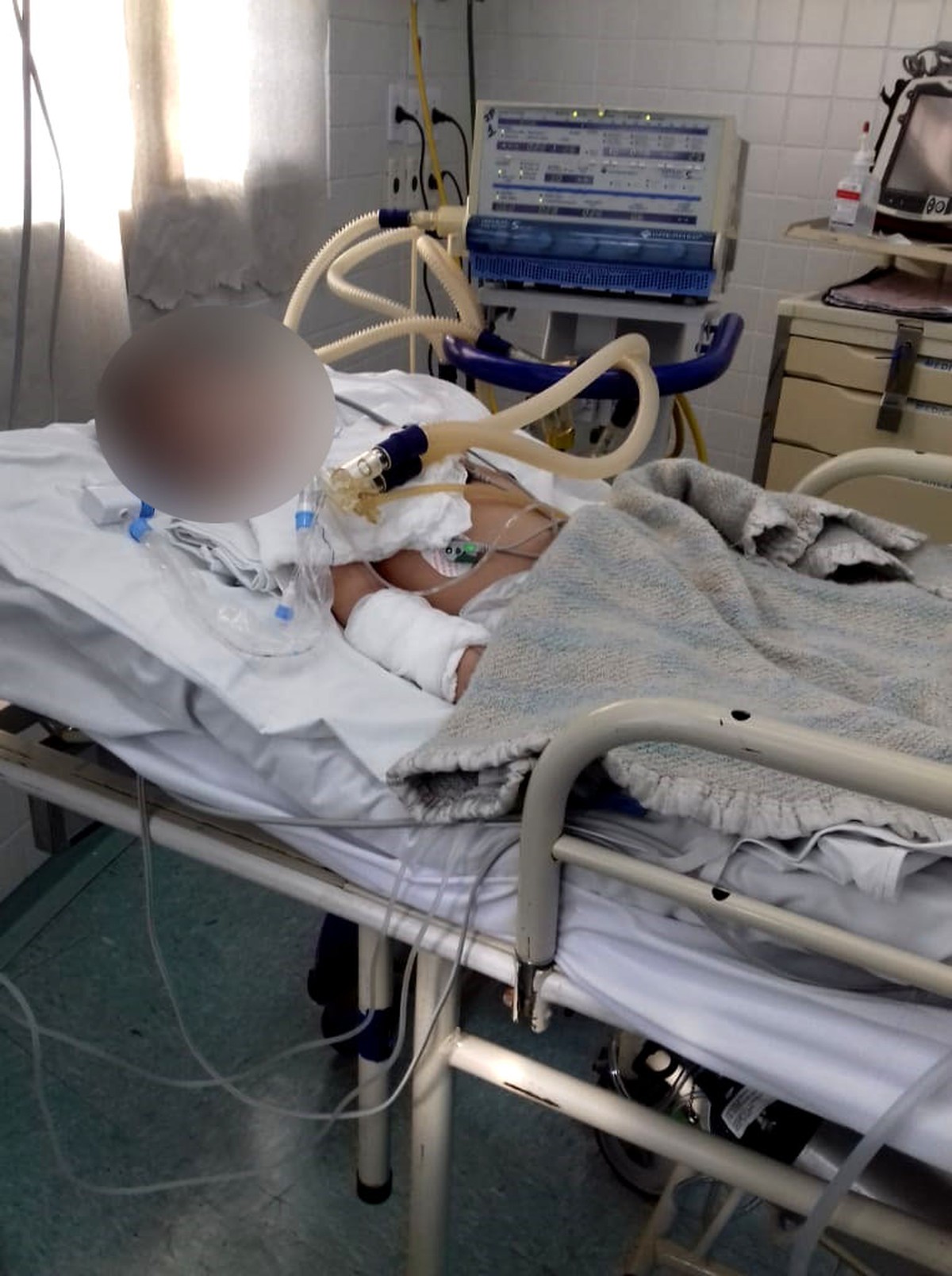 Hospital Mário Gatti tem leitos lotados e improvisa UTI Pediátrica em
