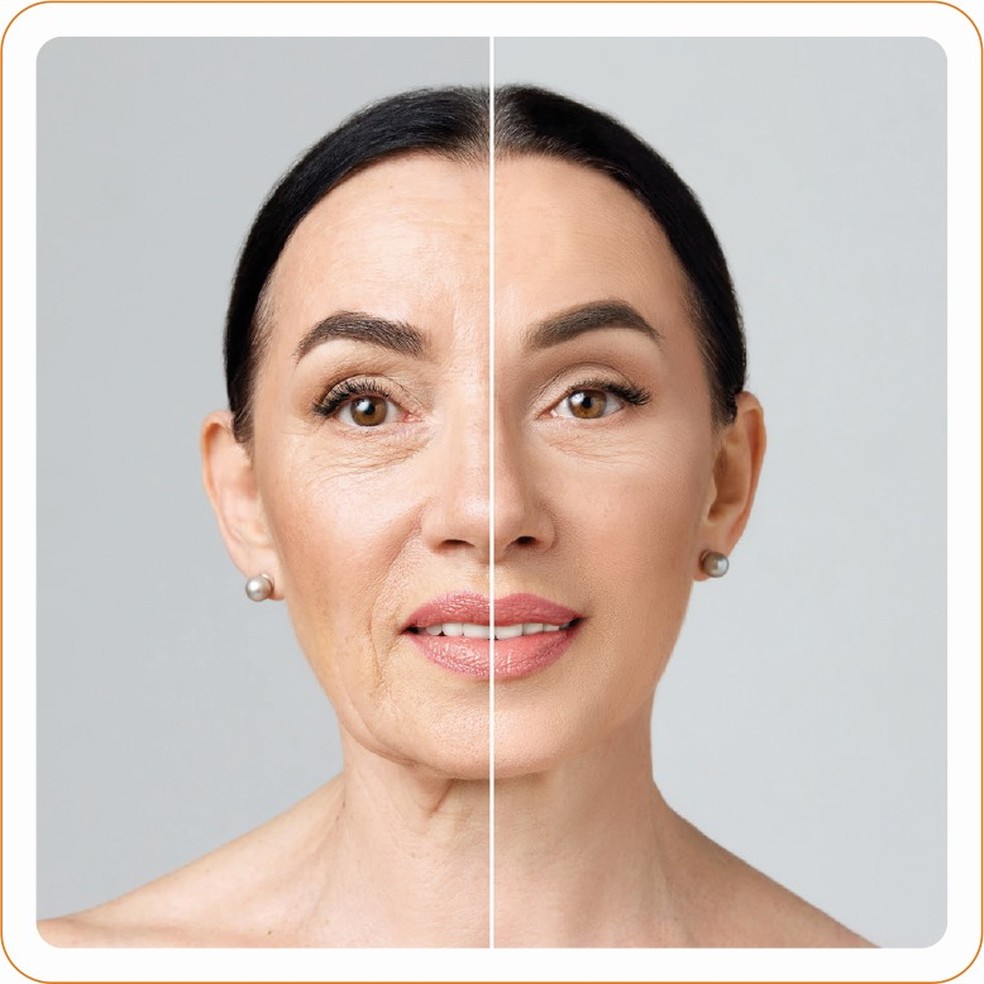 Hidroxicut Max Para Mulheres Antes E Depois