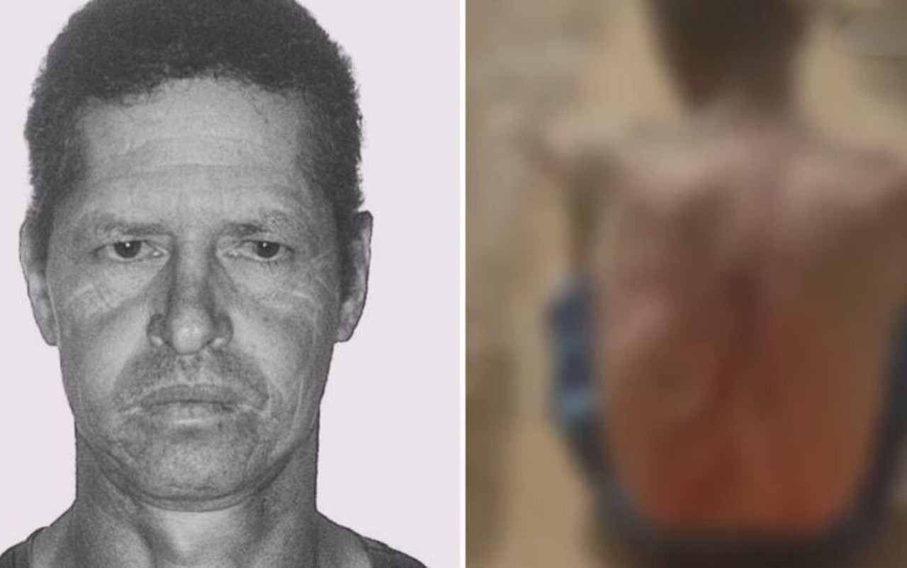 Homem morre ao ter o corpo queimado enquanto usava álcool para acender ...