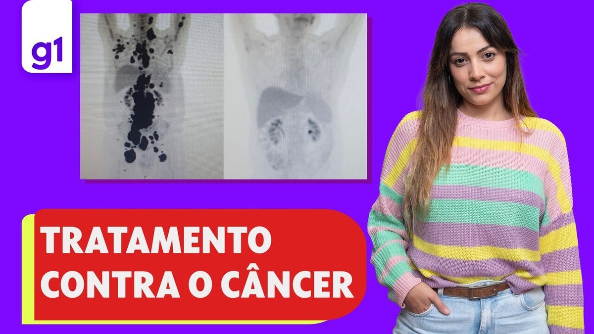 Como funciona o tratamento contra o câncer que fez paciente ter ...