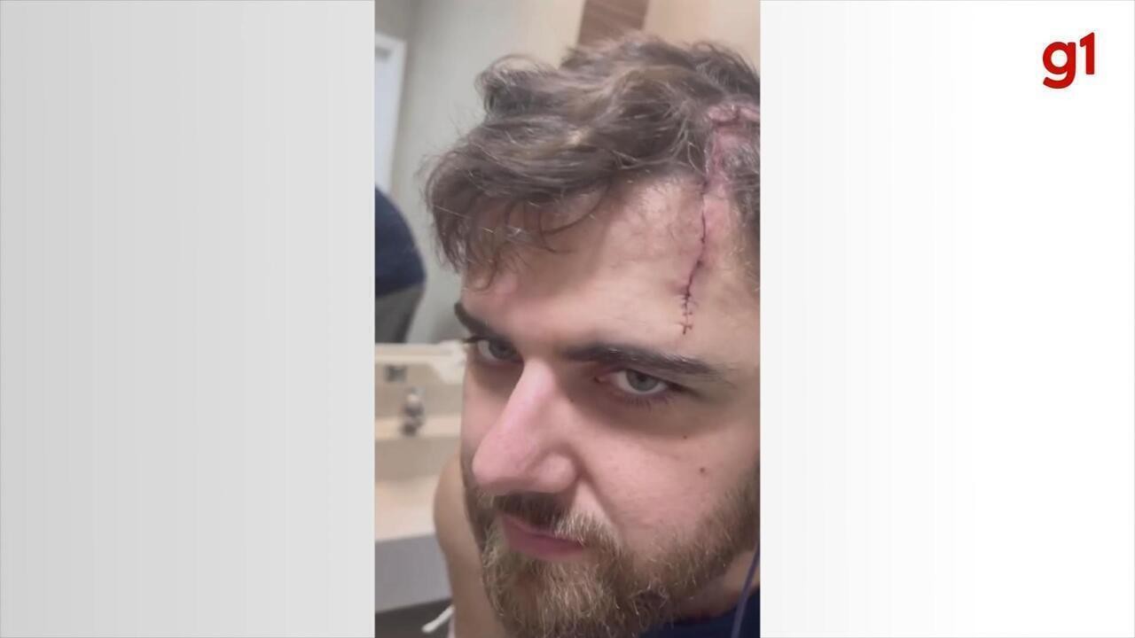 Cantor sertanejo Zé Neto sofreu dois acidentes em menos de um ano ...