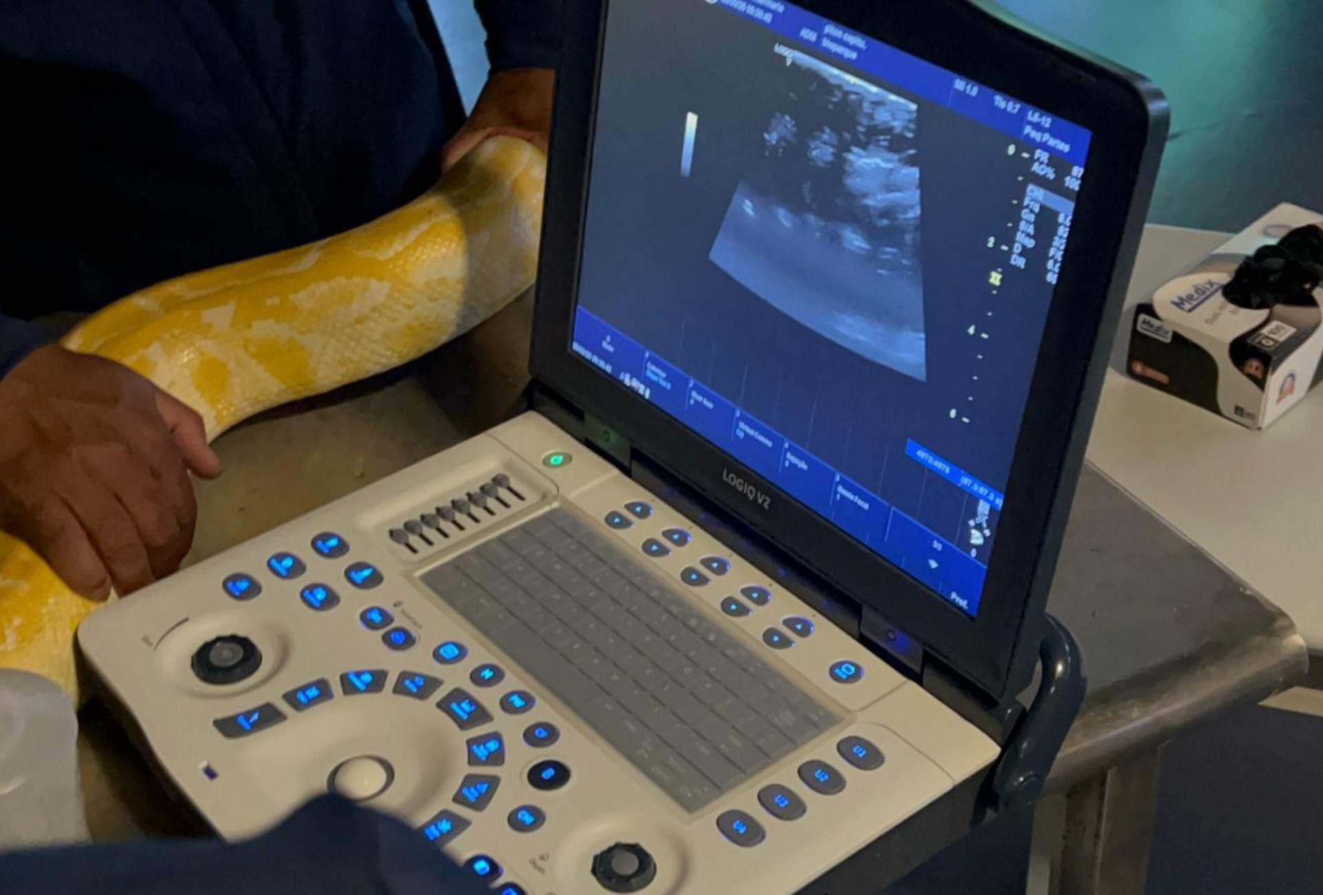 Ultrassom em cobra? Veja como a píton albina Capitu é cuidada em MS | G1