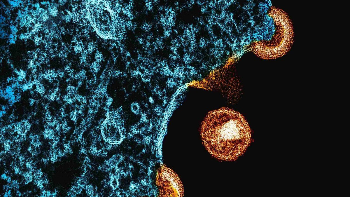 Pesquisa identifica nova variante do HIV, vírus da Aids, em três ...