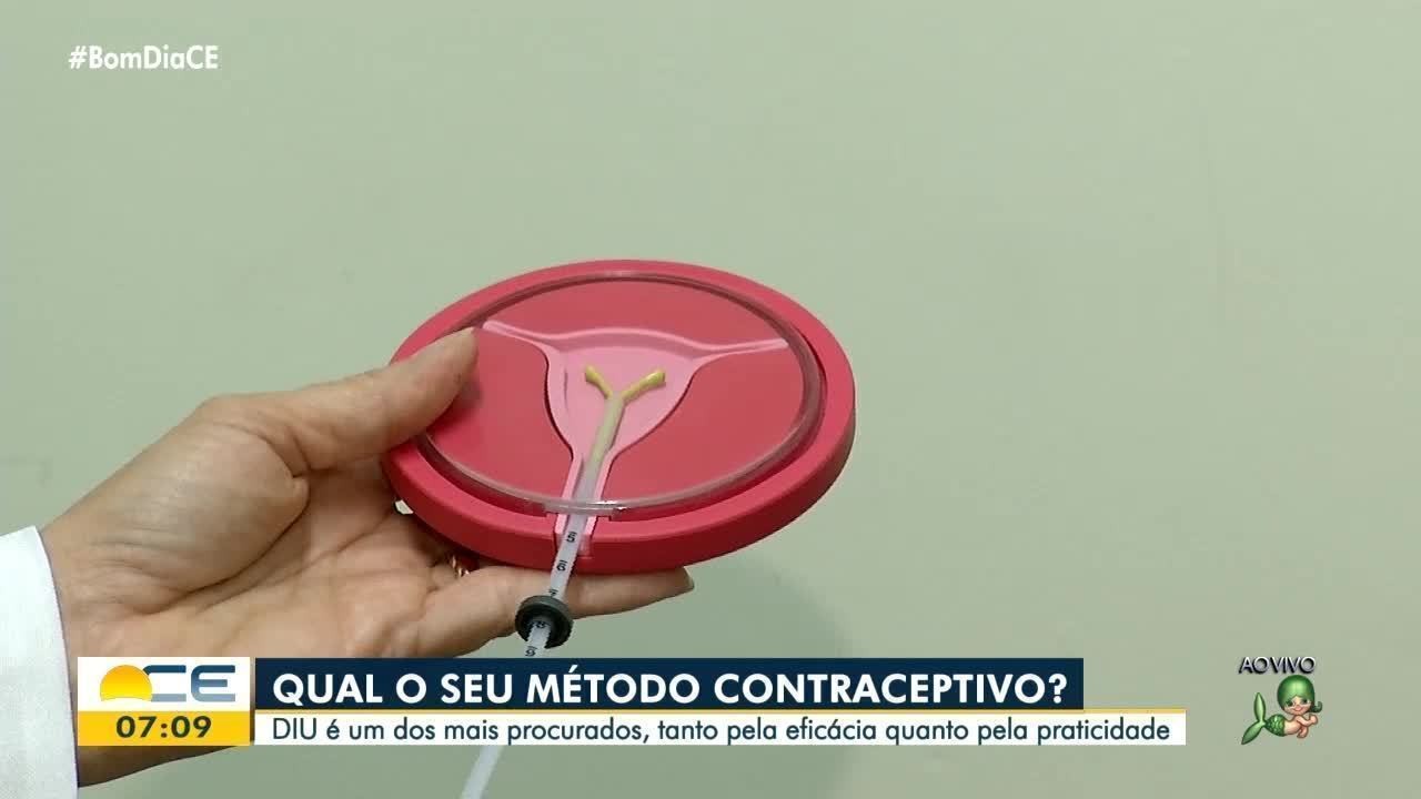 Como e onde implantar DIU na rede pública em Fortaleza | G1