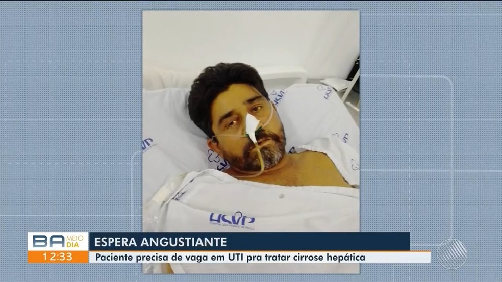 Paciente Com Cirrose Hepatica