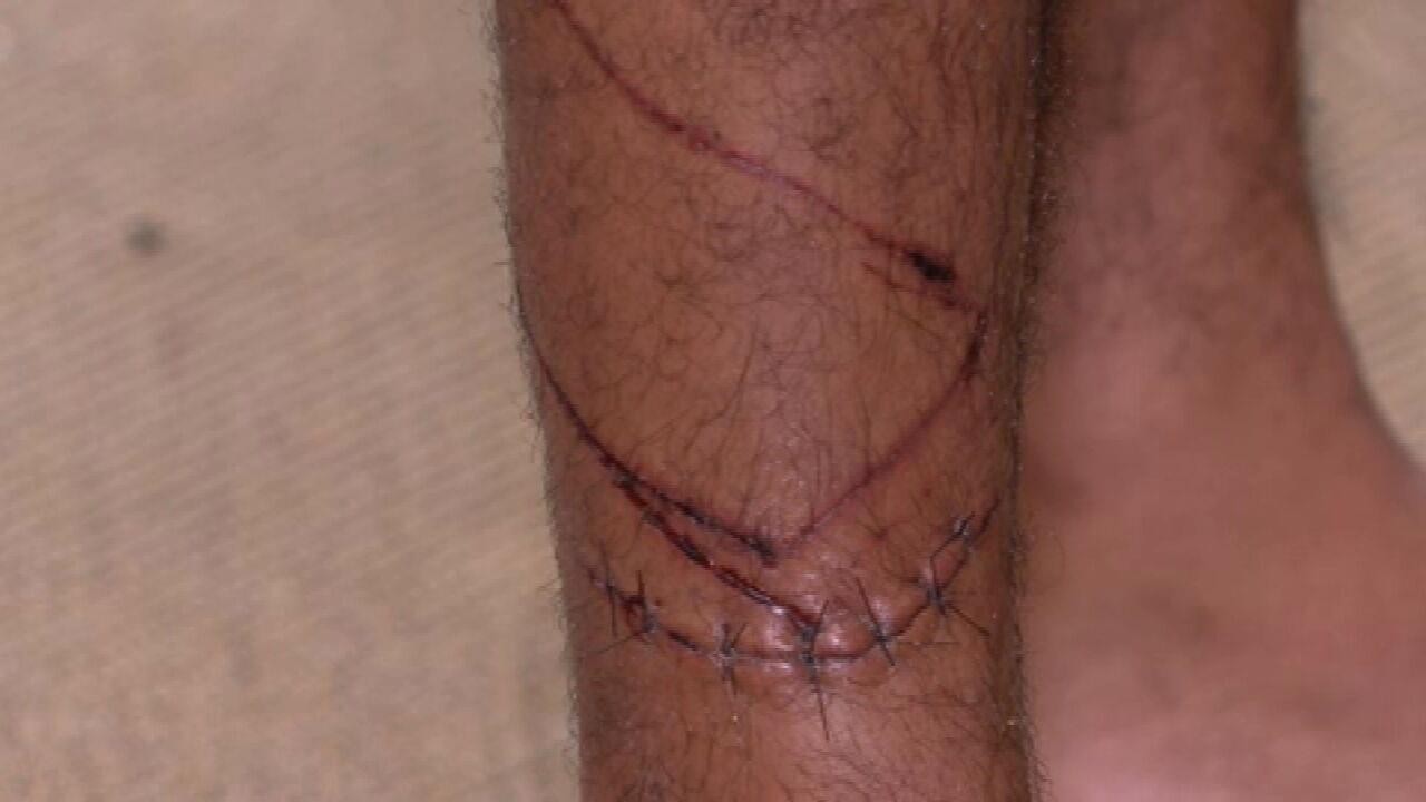 Capivara ataca homem que fazia exercícios no Lago Paranoá, em Brasília ...