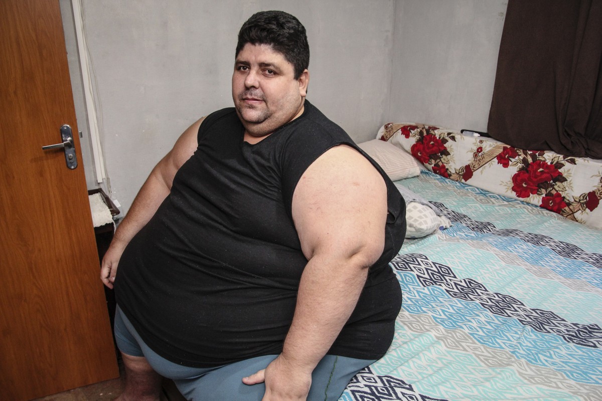 Homem com 286 quilos ganha balão intragástrico para emagrecer: 'Nasce ...