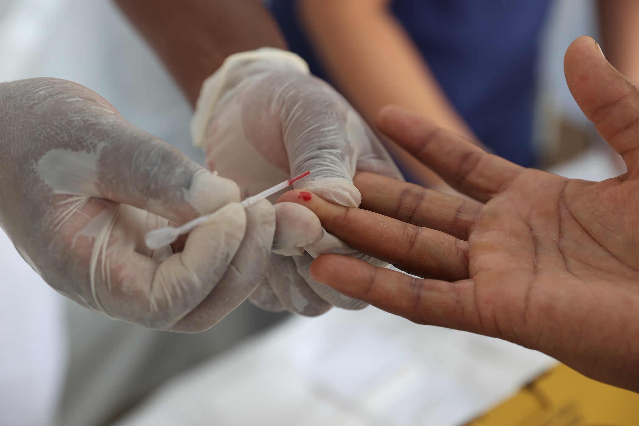 Casos de Aids caem 50% em um ano no RN; número de mortes teve redução ...