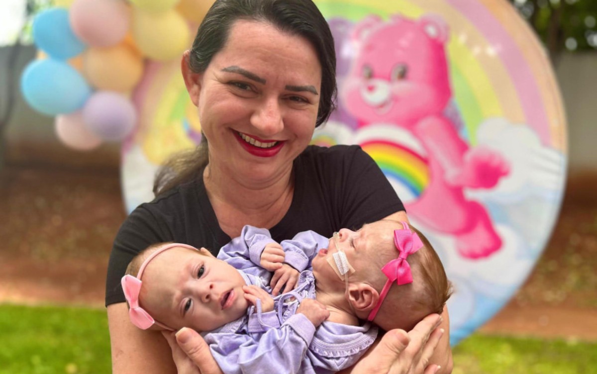 Siamesas Lara e Larissa, que nasceram unidas pelo tórax, abdômen e bacia, recebem alta da UTI ...