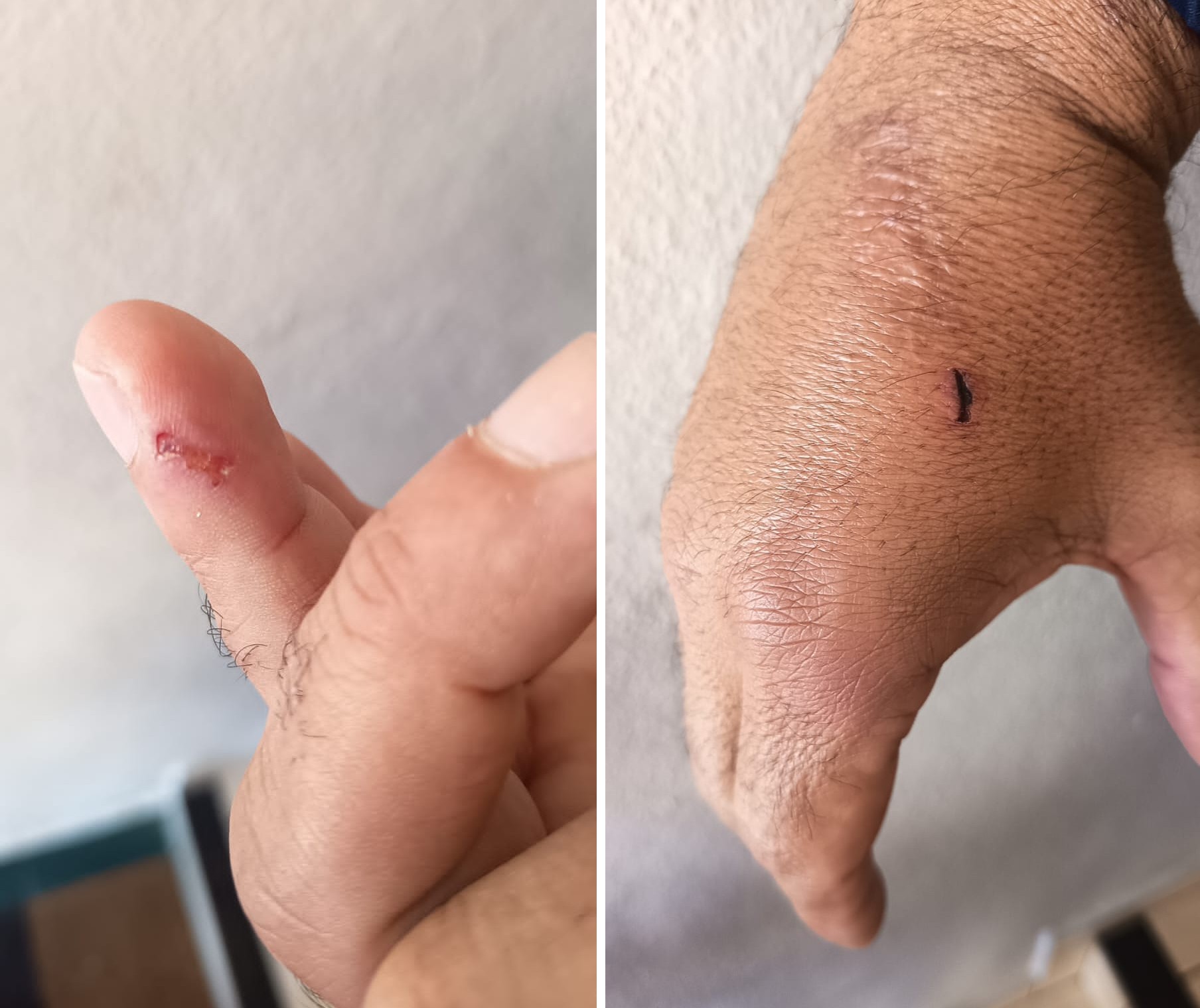 PMs são mordidos por homem durante abordagem em Bom Jesus do Itabapoana ...