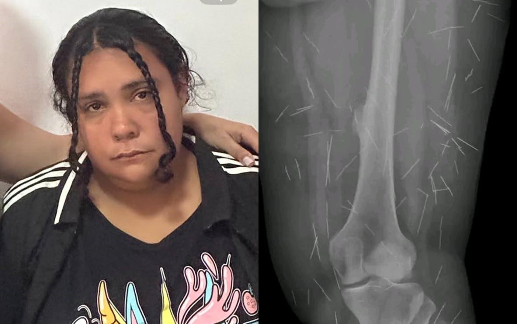 Mulher que fingiu ter 12 anos em SC já tinha sido presa em Goiás | G1