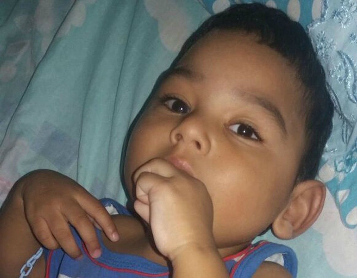 Bebê com microcefalia e cegueira espera há oito meses por cirurgia e ...