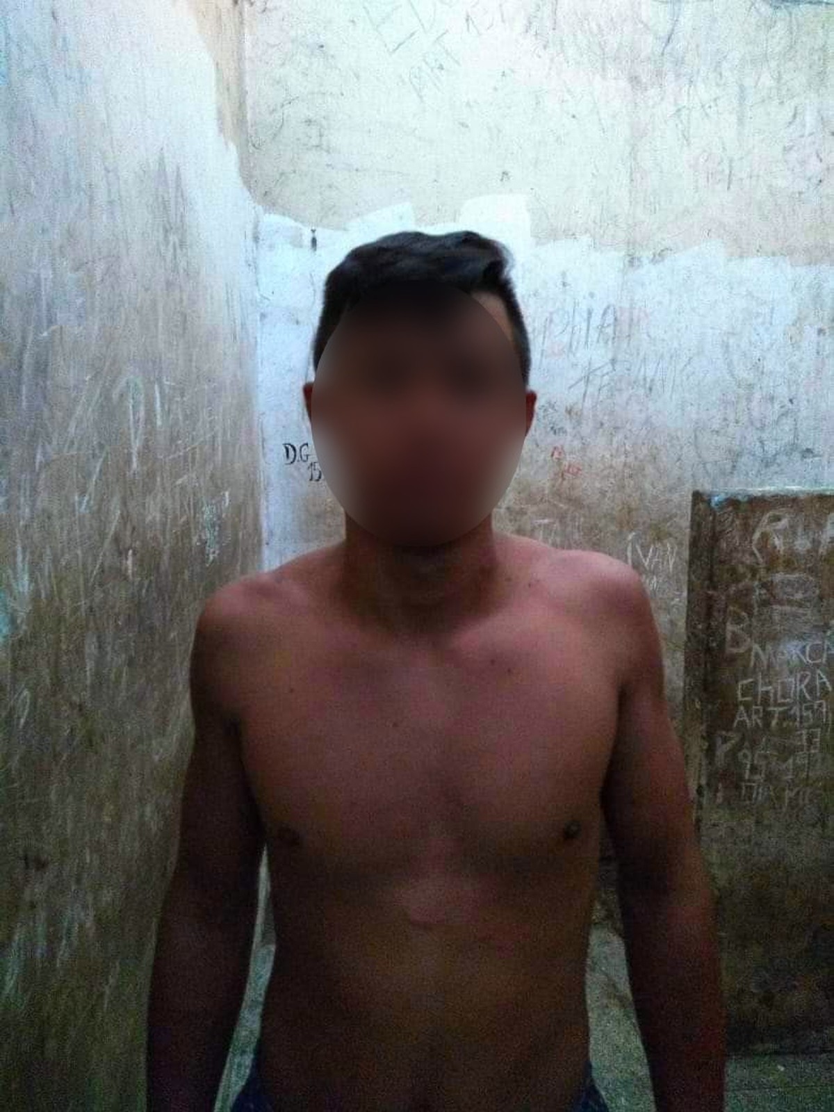 Homem é Preso Após Arrancar Pedaço De Orelha De Esposa Durante
