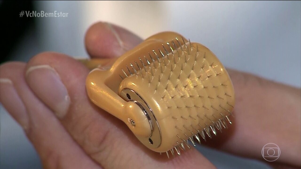 Microagulhamento: entenda o que é e como funciona a técnica que promete ...