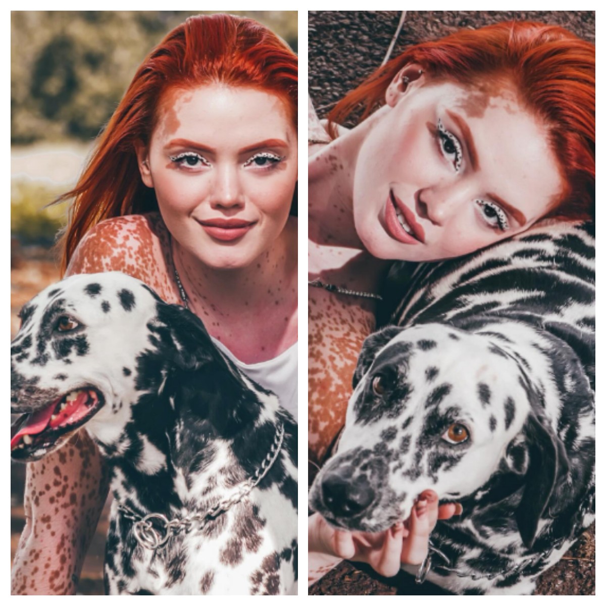 Influencer com vitiligo teve problema de identidade racial | G1