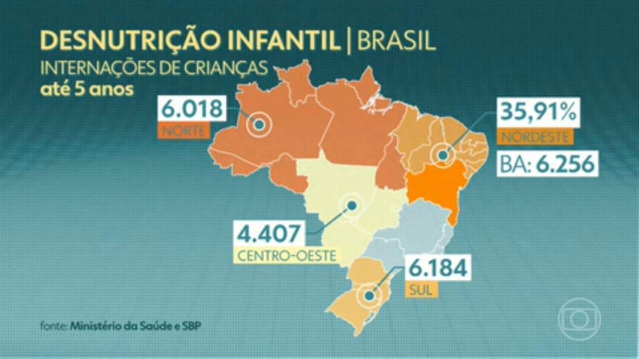 Número de internações de crianças por desnutrição no Brasil é o maior ...