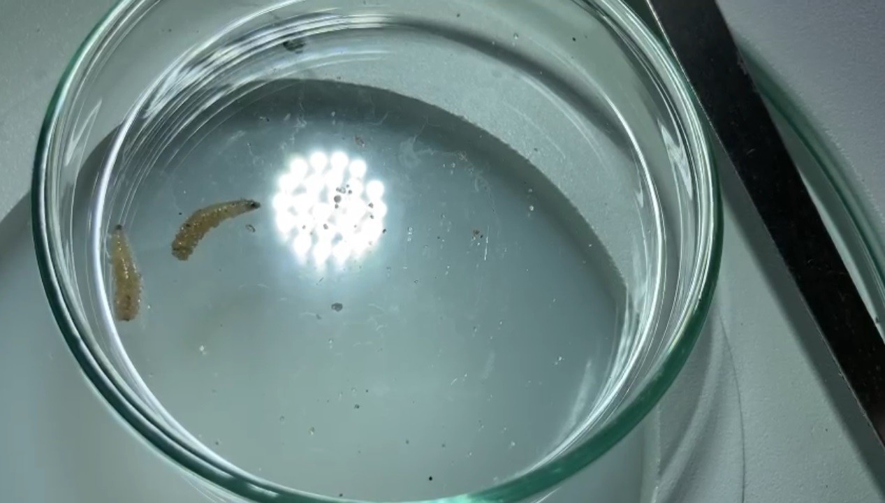 Entenda o que é miíase, infestação de larvas de moscas na pele humana ...