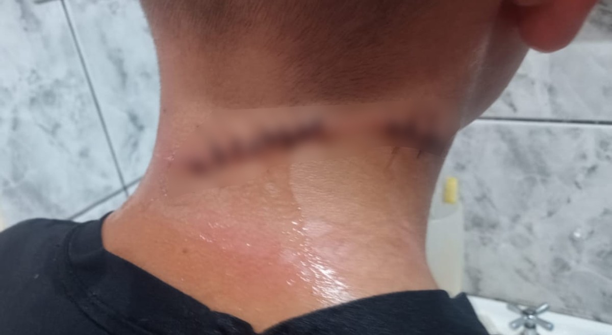 Criança de 11 anos é socorrida com ferimento no pescoço causado por ...