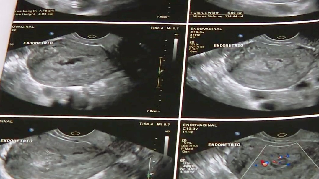 Capivari | Cidade | G1