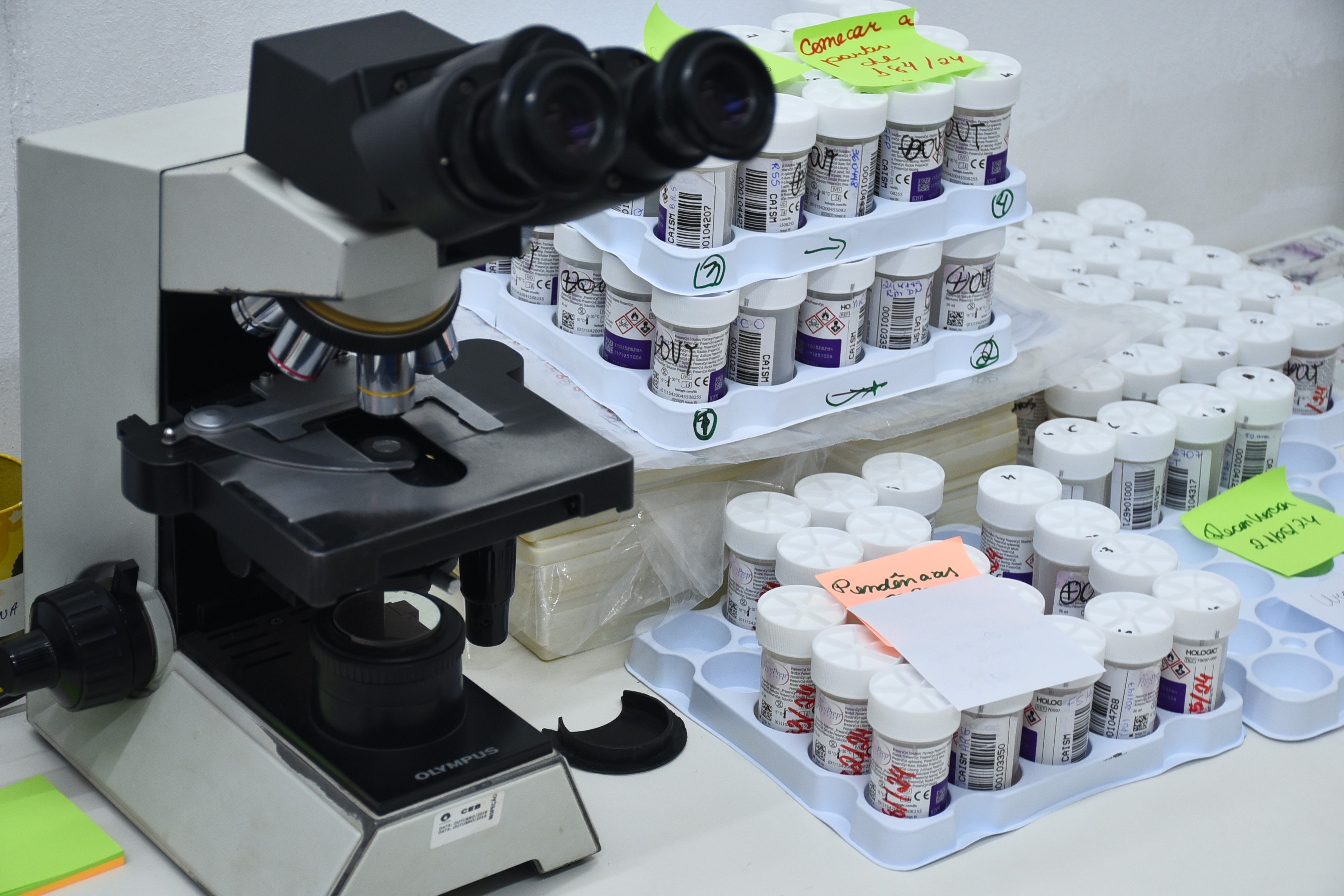 Entenda como teste de DNA pode substituir papanicolau na detecção do HPV