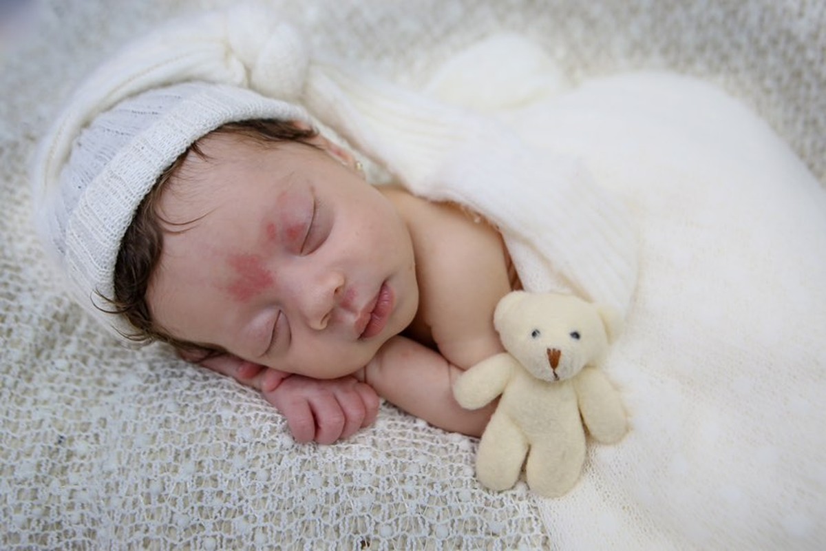 'Bebê do amor': menina nasce em Jundiaí com marca em formato de coração ...