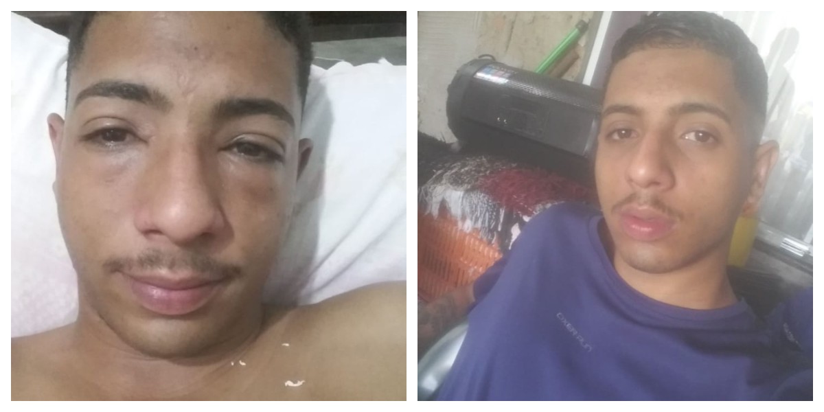 Jovem 'incha' e fica com garganta fechada após tomar injeção em SP ...
