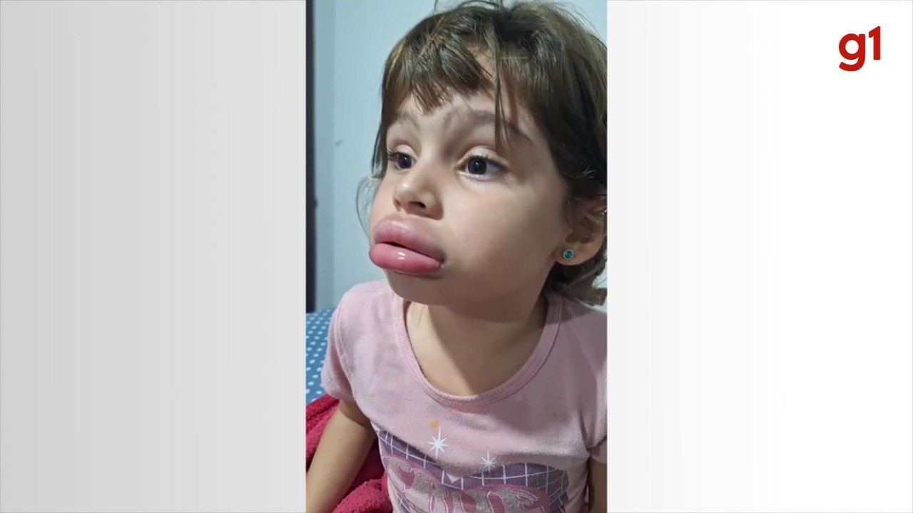 Vídeo com reação de criança ao ver lábios inchados após sugar tampinha ...