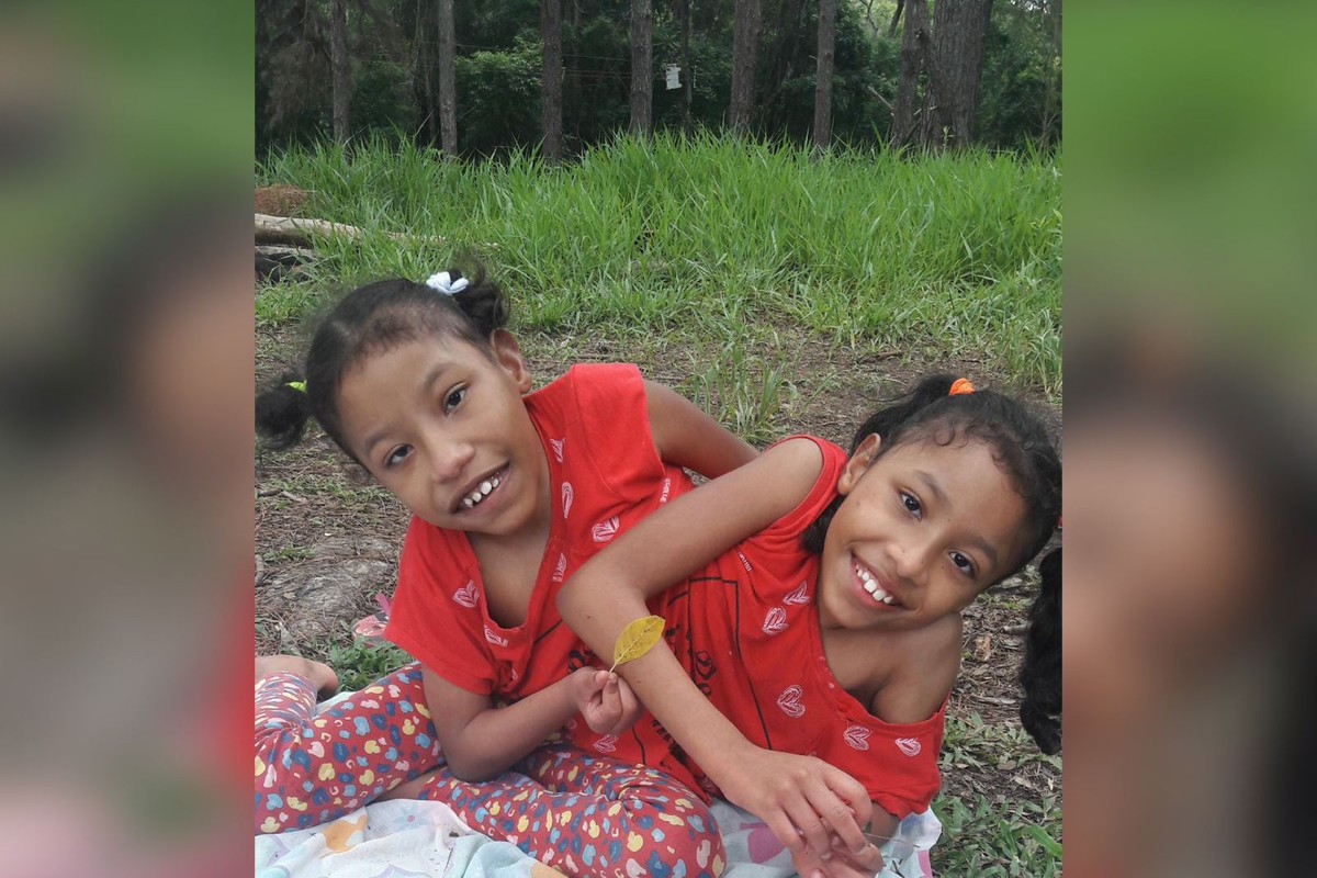 Gêmeas siamesas de 13 anos falam sobre rotina e possível 'separação ...