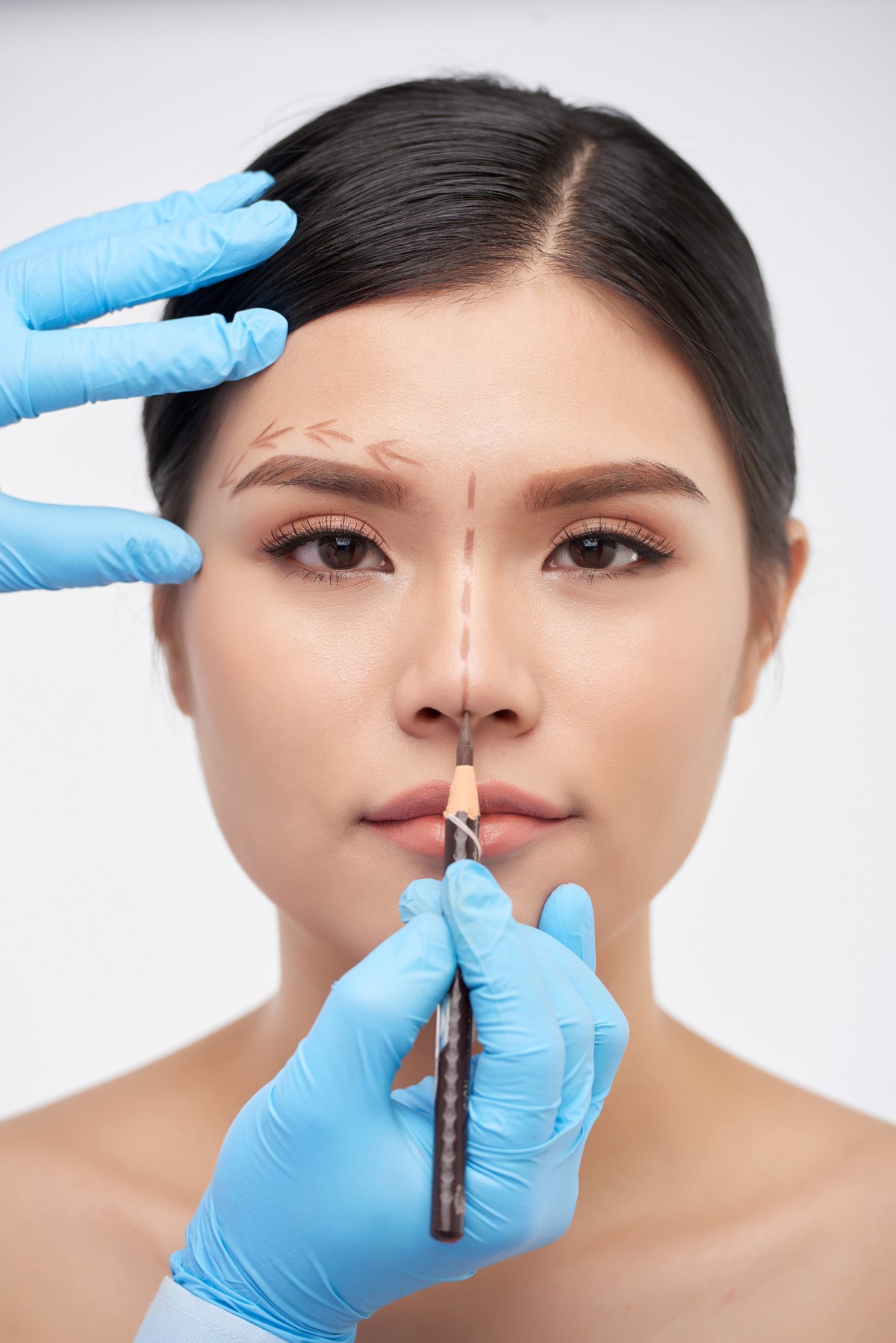 Rinoplastia não é tudo igual! | Tudo Sobre Cirurgia Plástica | G1
