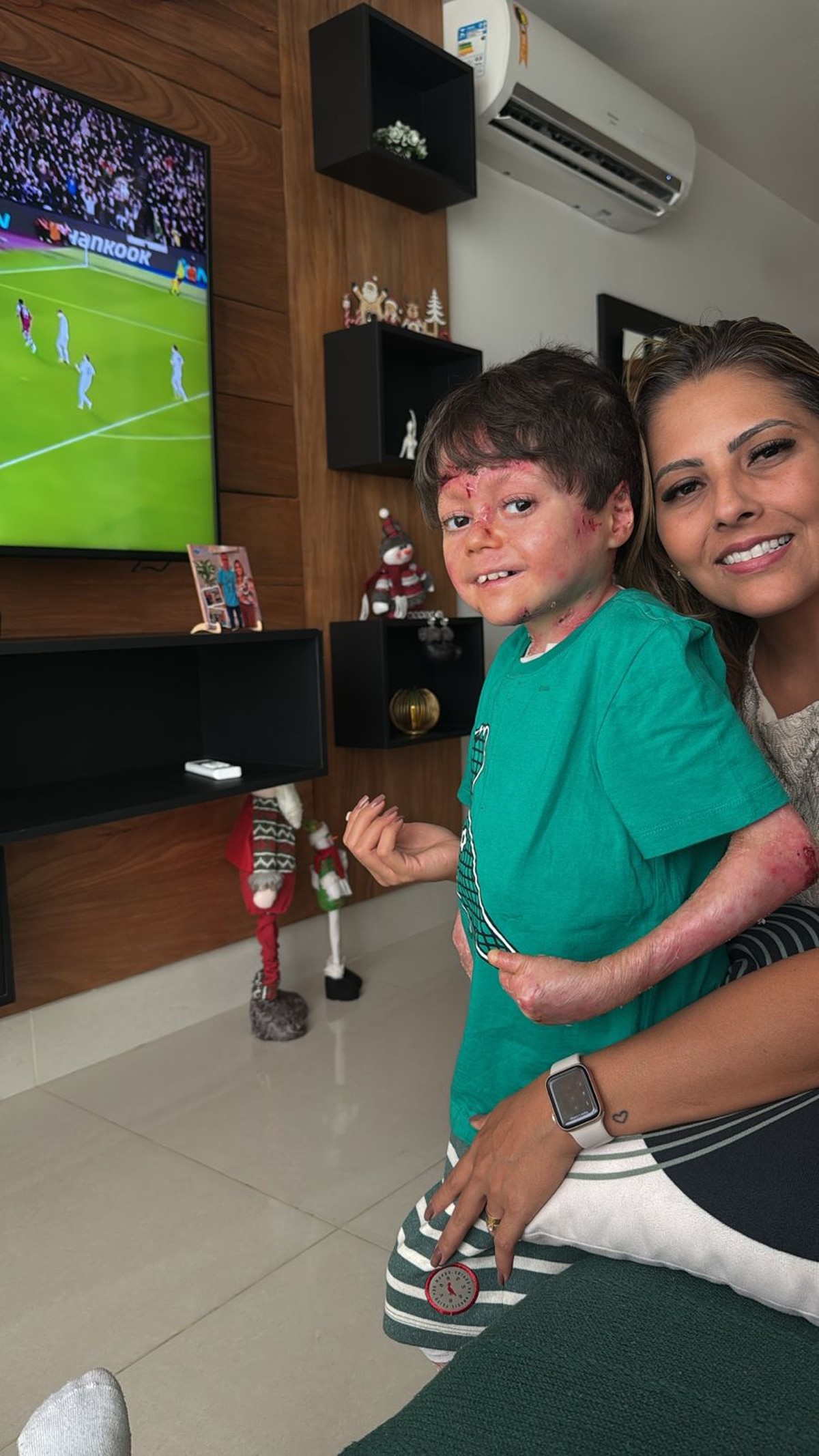 Quem é Gui, torcedor vascaíno vencedor de prêmio da Fifa, que sofre de epidermólise bolhosa ...