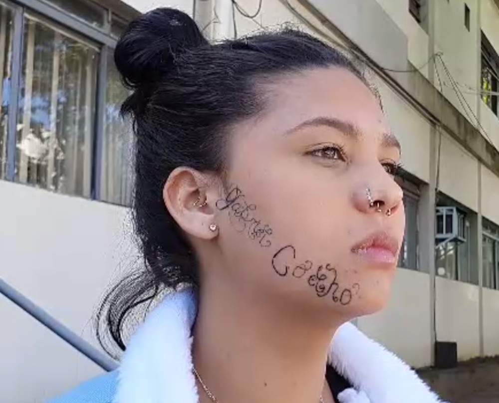 Um ano após ter rosto tatuado à força pelo ex, jovem segue tentando ...