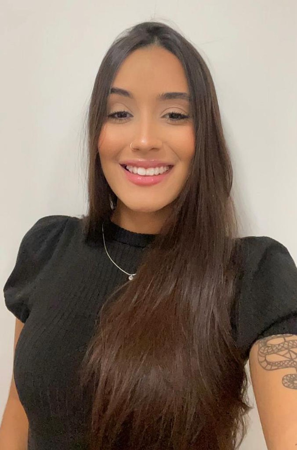 Estudante sofre reação alérgica ao corrigir preenchimento labial e faz ...