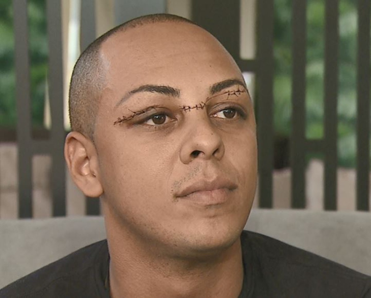 Auxiliar administrativo leva 14 pontos no rosto após ser ferido por ...