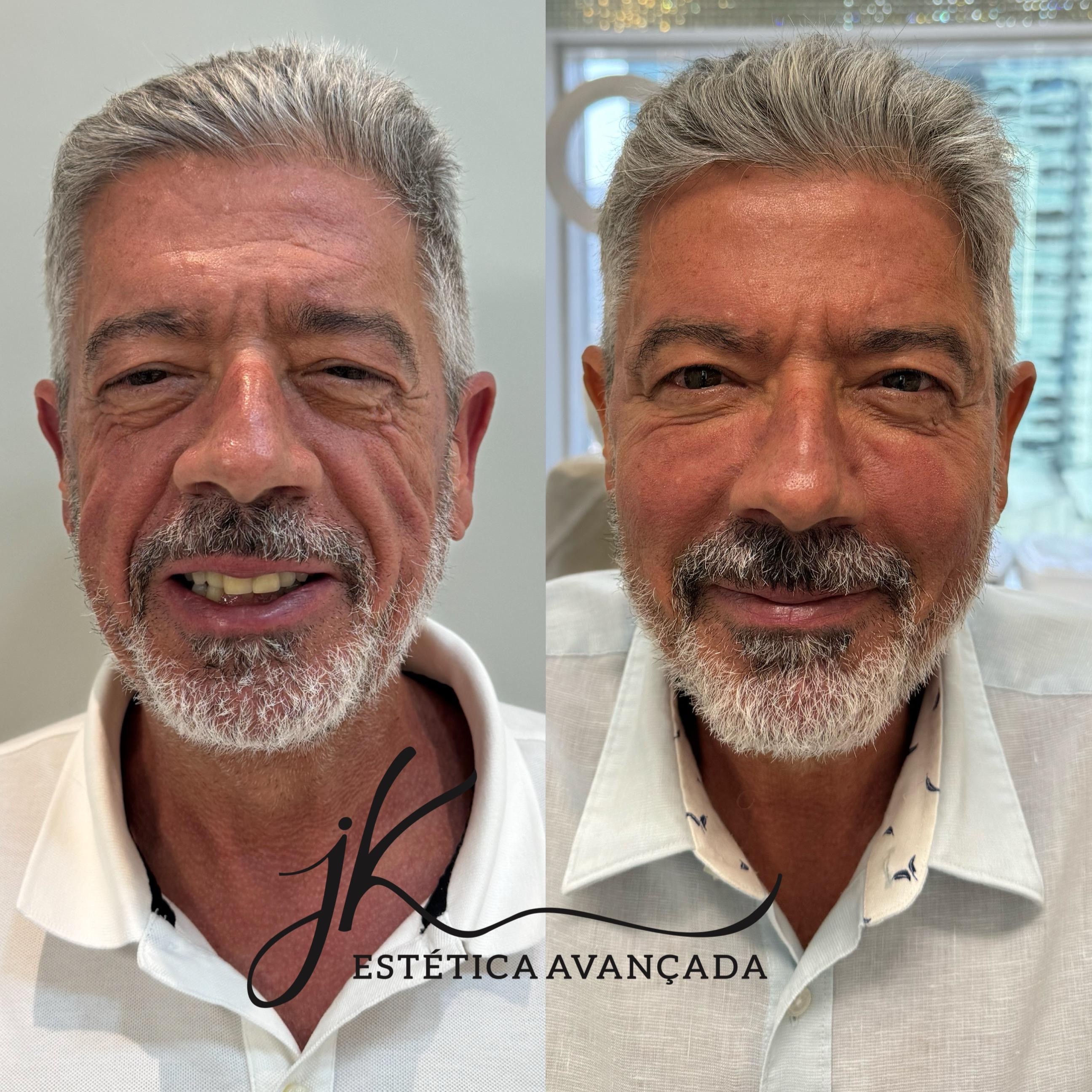Veja quais são os procedimentos mais procurados na JK Estética Avançada ...