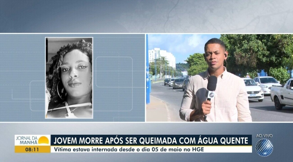 Jovem morre após ter rosto queimado com água quente na BA; família diz que cunhada cometeu ...