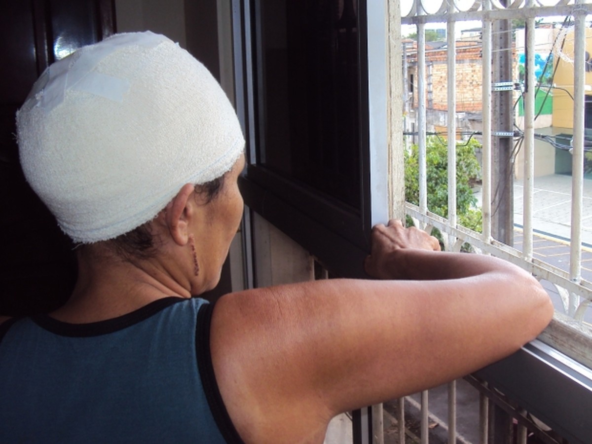 No AP, vítimas de escalpelamento poderão ser incluídas em benefício do ...