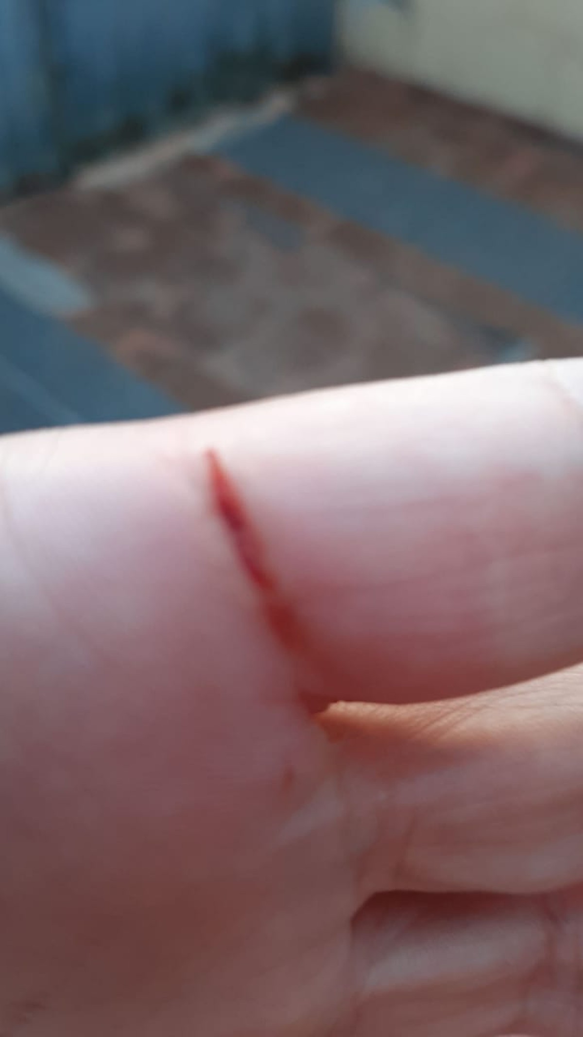 Motociclista fica ferida após ser atingida por linha com cerol em Rio ...