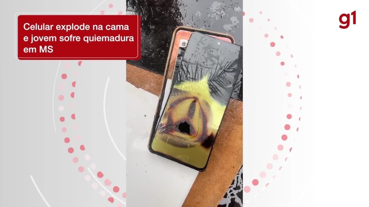 Celular explode e queima jovem enquanto dormia em MS; VÍDEO | G1