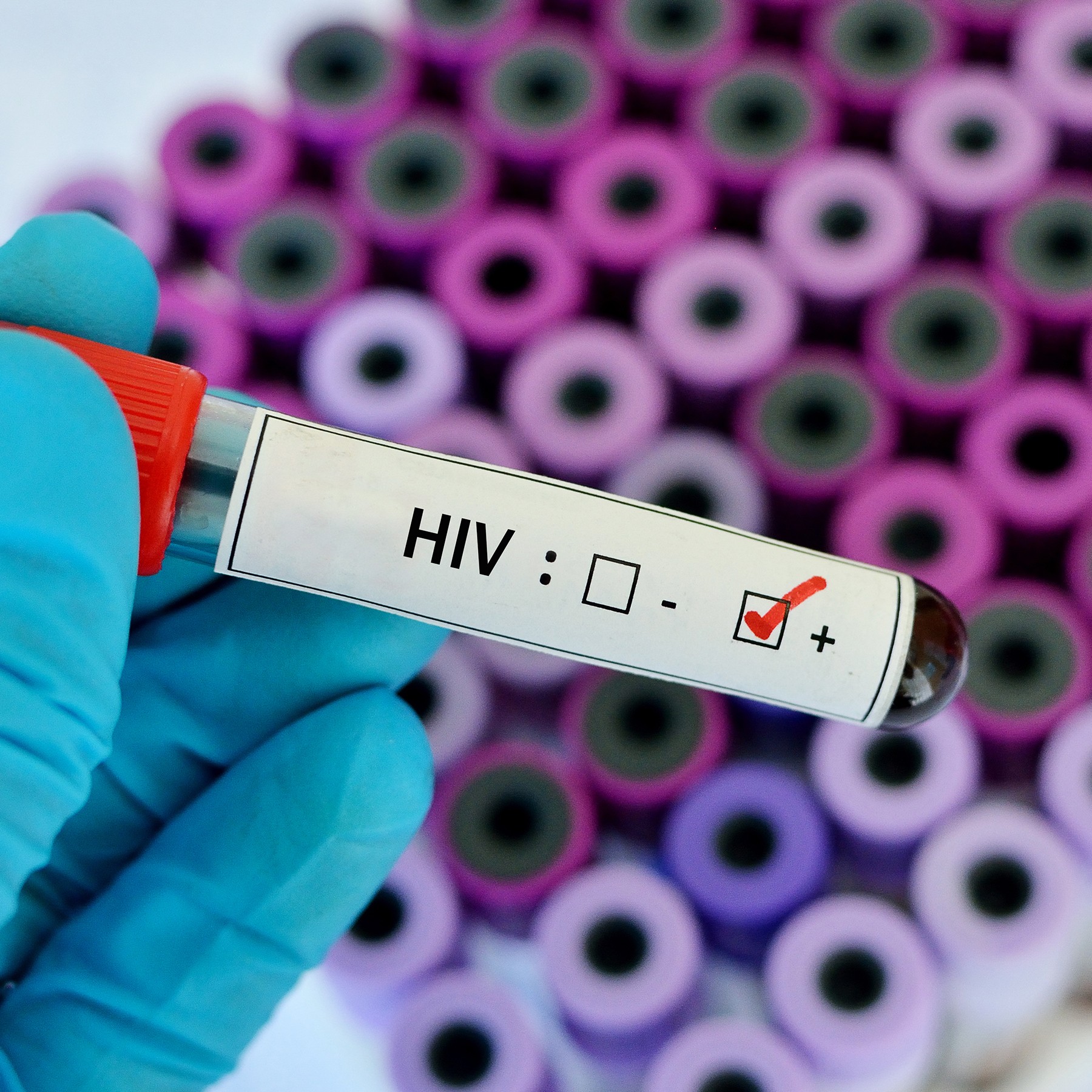 OMS alerta que suspensão de recursos dos EUA a programa de Aids pode ...