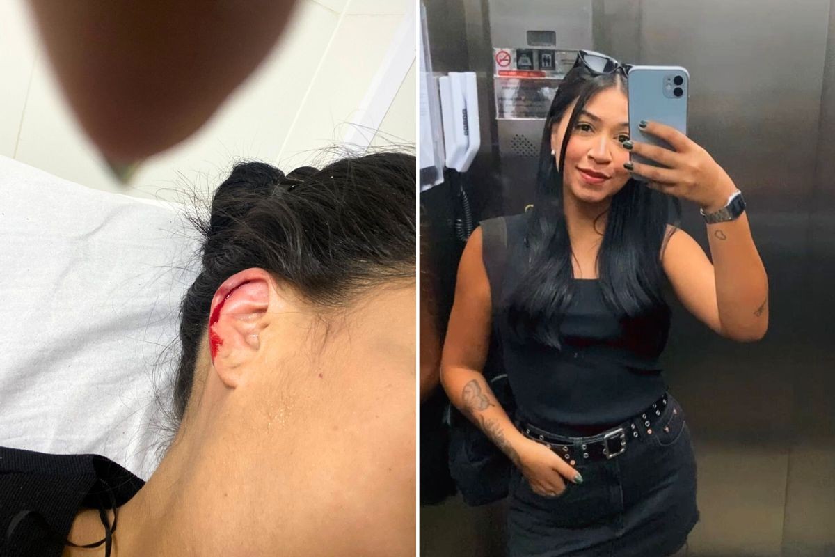 Jovem leva soco de morador em situação de rua a caminho do trabalho e ...