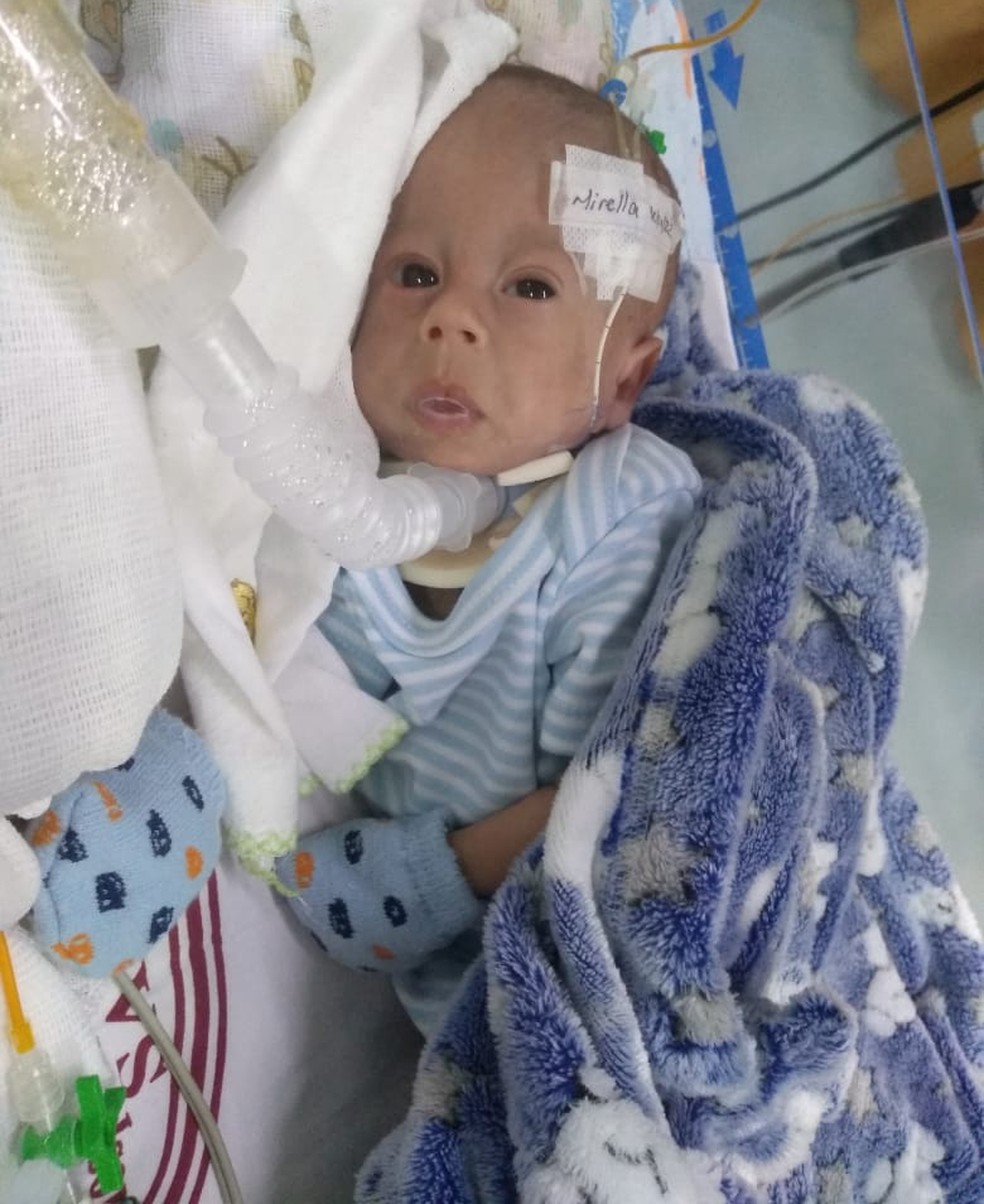 Sintomas Da Sindrome De Edwards Síndrome De Diógenes: Revisão