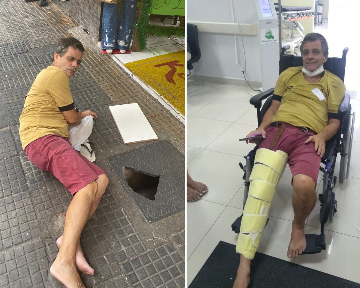 Idoso rompe o músculo da perna após cair em buraco de esgoto no litoral ...