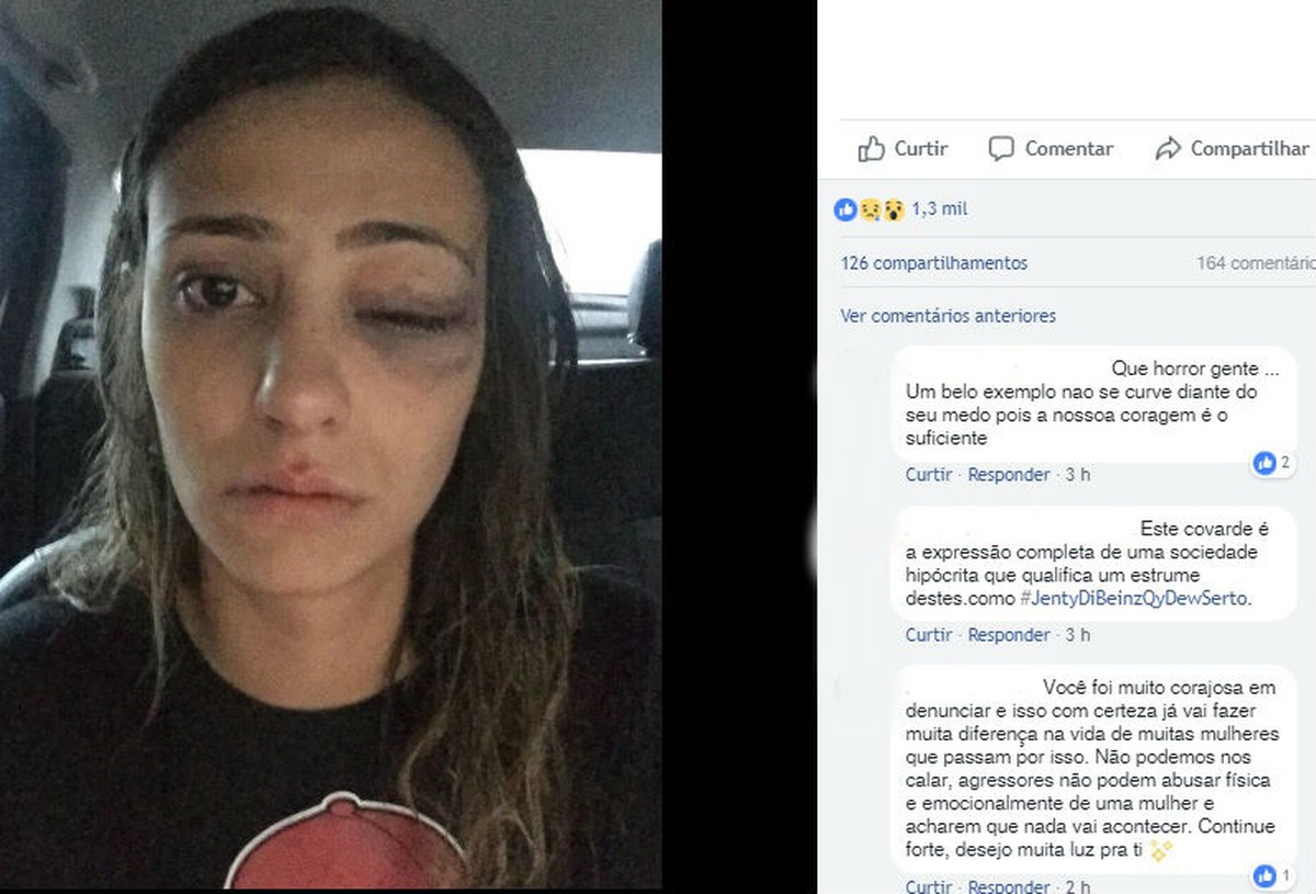 Polícia Civil Investiga Denúncia De Agressão Feita Por Ex Namorada