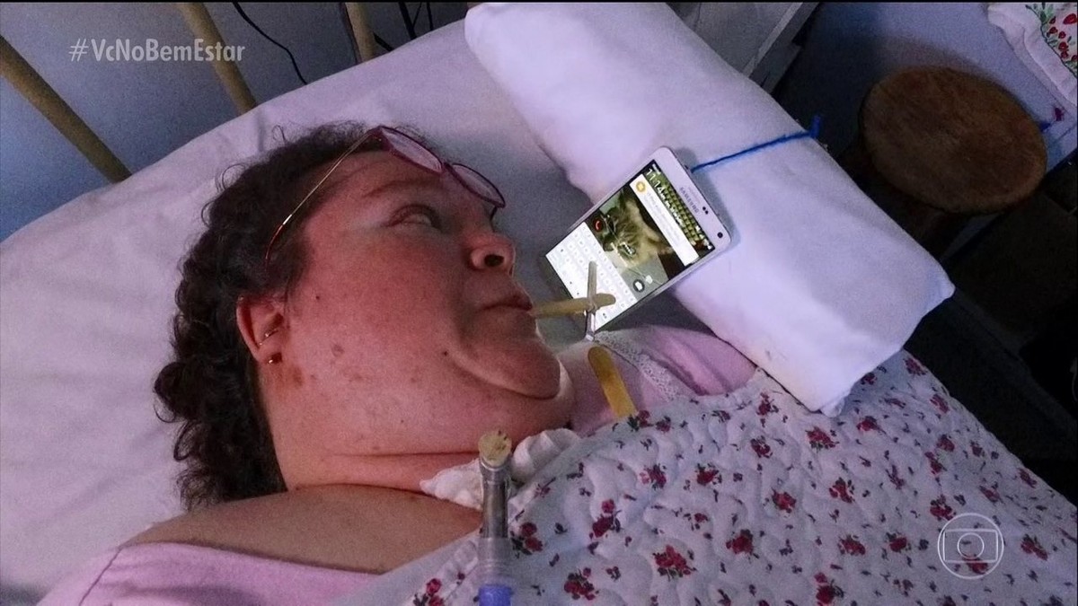 Paciente que vive há mais de 40 anos em hospital com pólio alerta ...