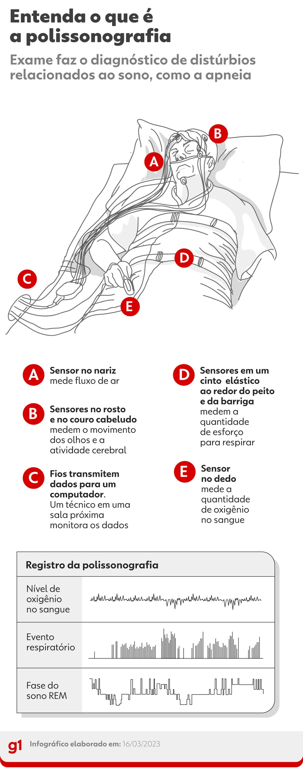 Polissonografia: mais de 12 mil brasileiros aguardam na fila para fazer ...