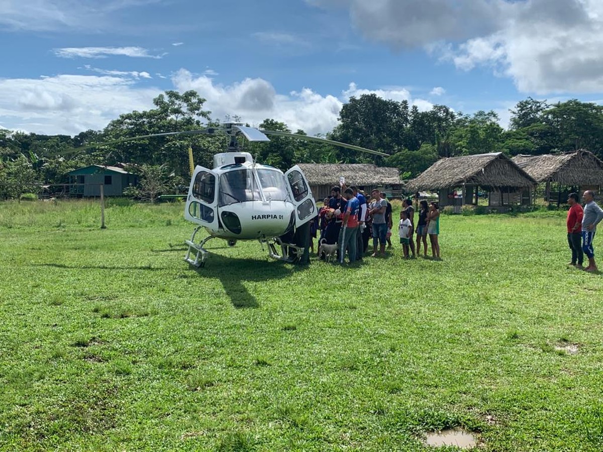 Bebê indígena de 9 meses é resgatada com desnutrição em aldeia no AC ...