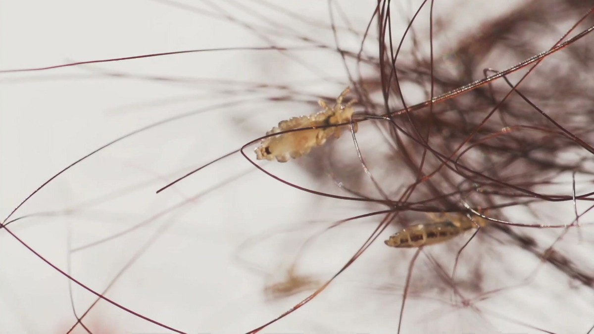 Como as pessoas pegam piolhos? | Ciência e Saúde | G1