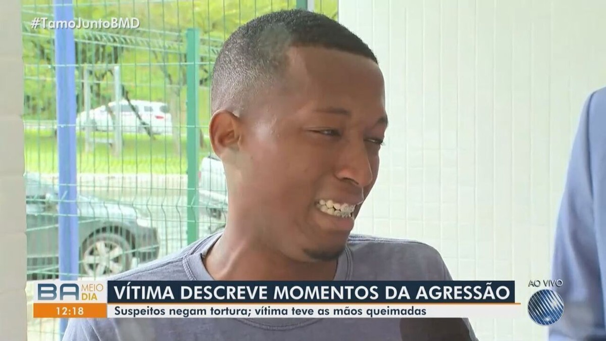 'Ele me queimava devagar, disse que não queria estar na minha pele', relata trabalhador ...