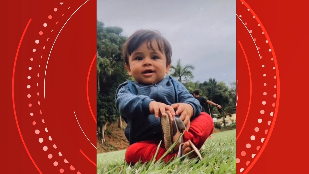 Bebê que teve 40% do corpo queimado ao derrubar vasilha cheia de ...