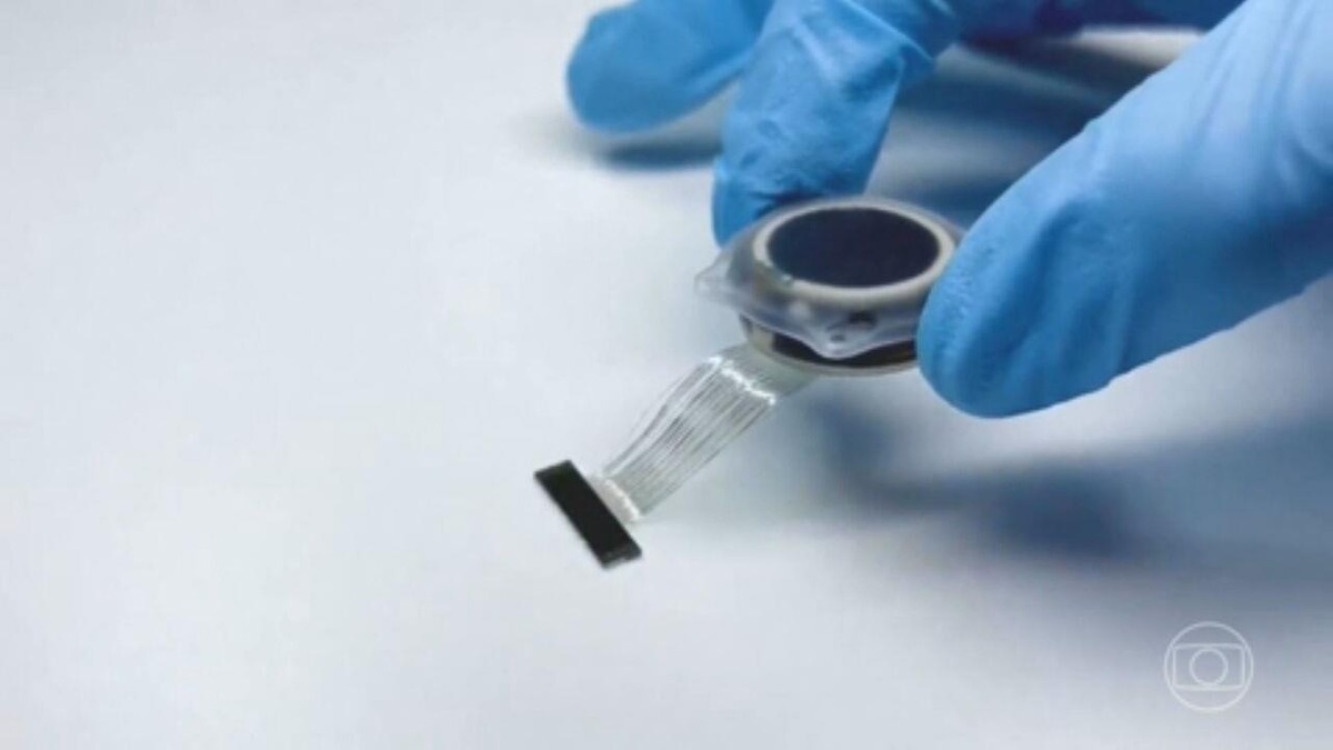 Neuralink De Elon Musk Faz 1º Implante De Chip Cerebral Em Humano